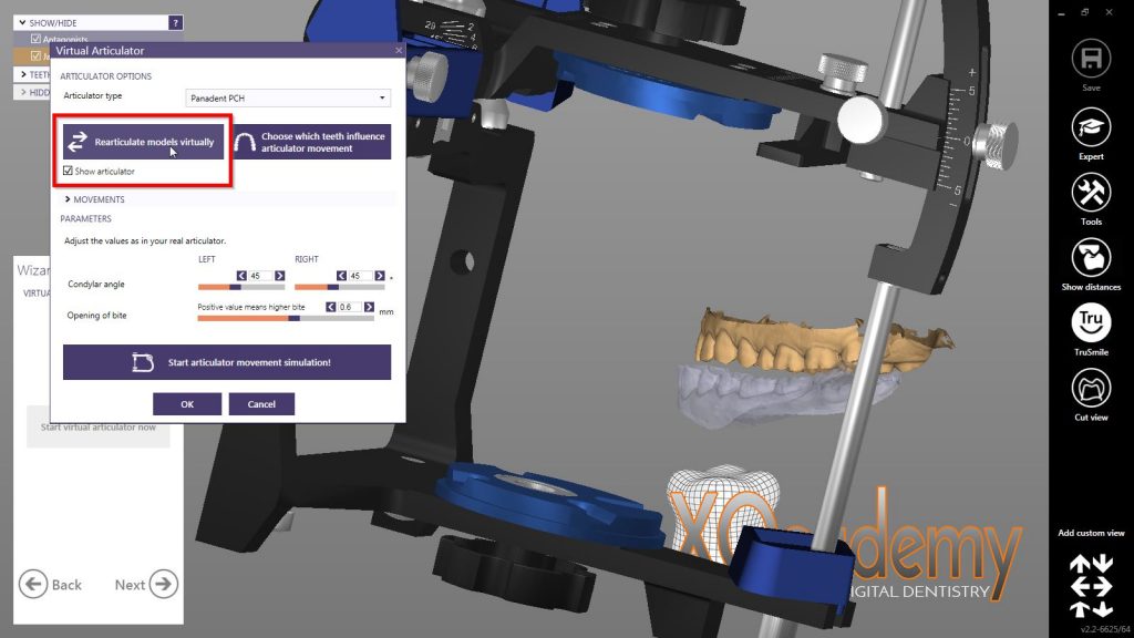 exocad Ultimate Lab Bundle – XOcademy