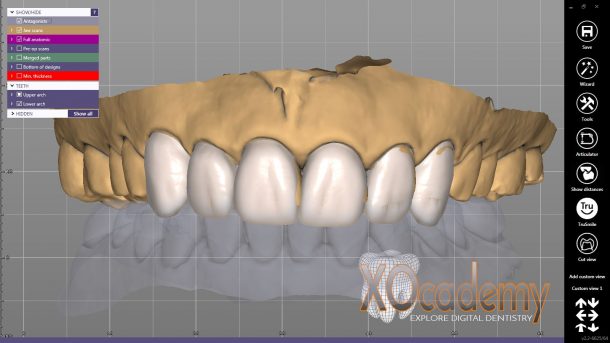 exocad Ultimate Lab Bundle – XOcademy