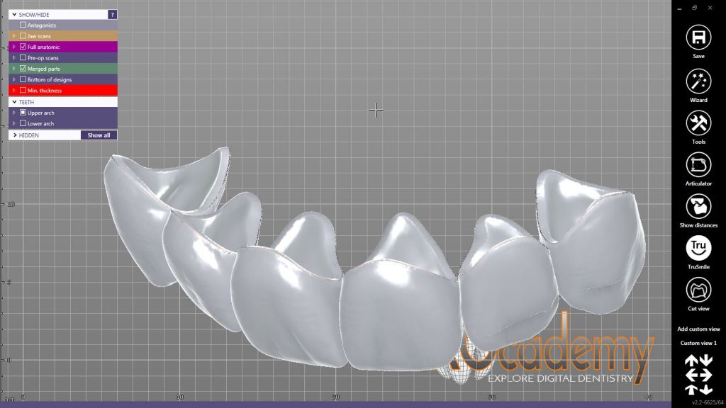 exocad Ultimate Lab Bundle – XOcademy