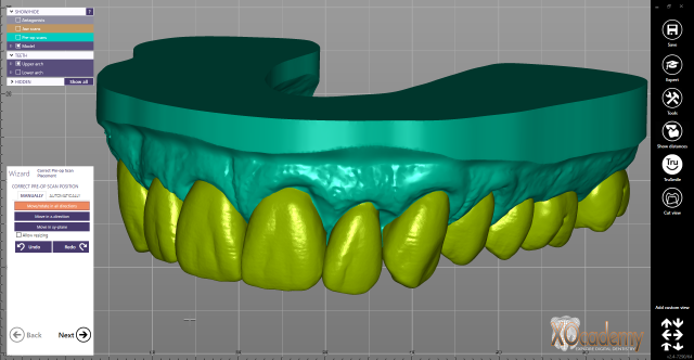 XOcademy – explore digital dentistry